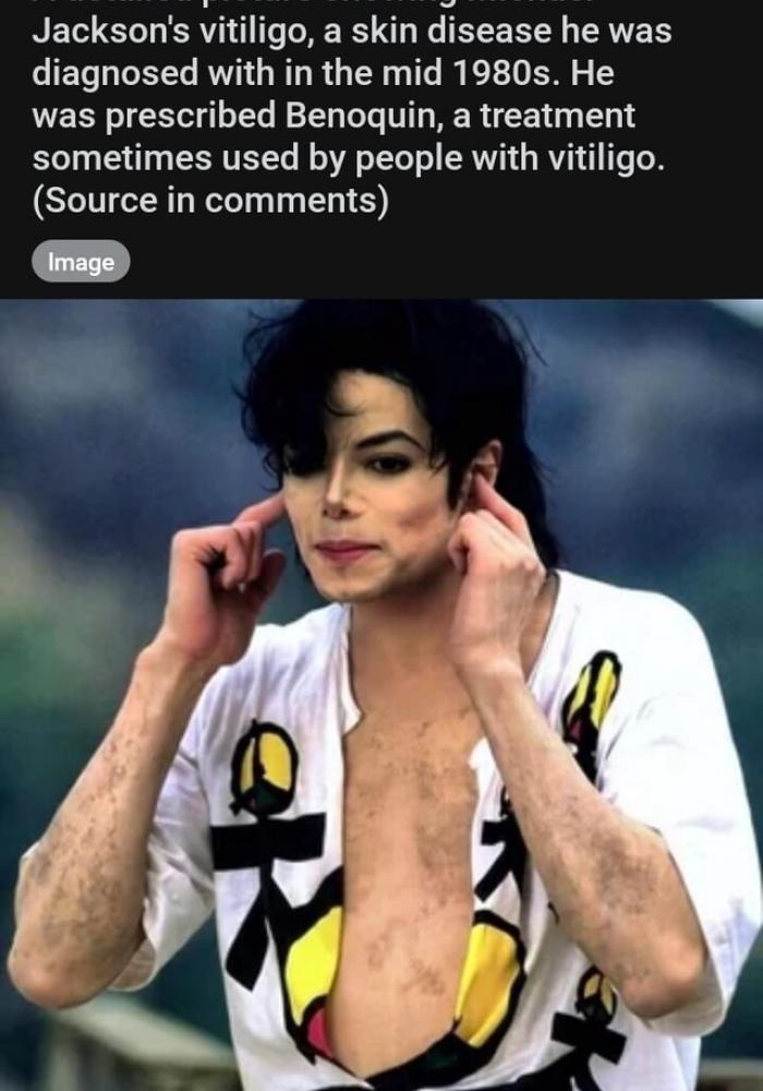 Michael Jackson (RASPY) SQ TTS Computer AI Voice Soundboard