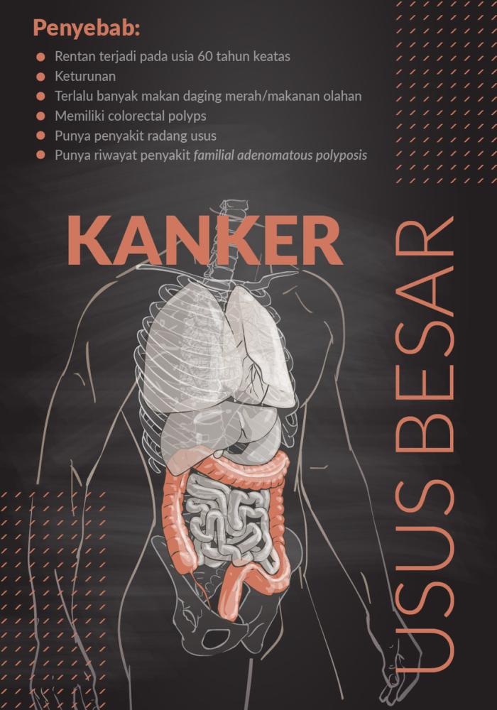 💬 Kanker Soundboard